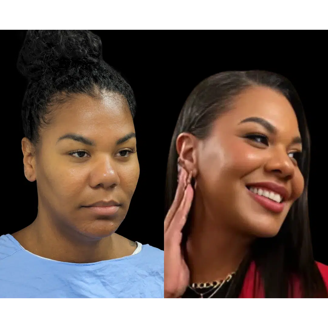 Lashes - Maryland Plastic Surgery